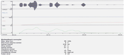 Urinary Incontinence and Biofeedback